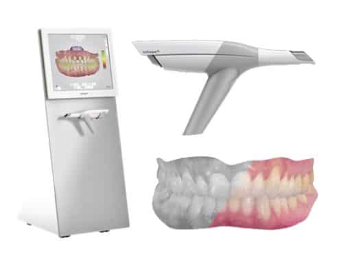 3Shape TRIOS® 3 von Straumann – der intraoral Scanner – Batyr Kuliev ...